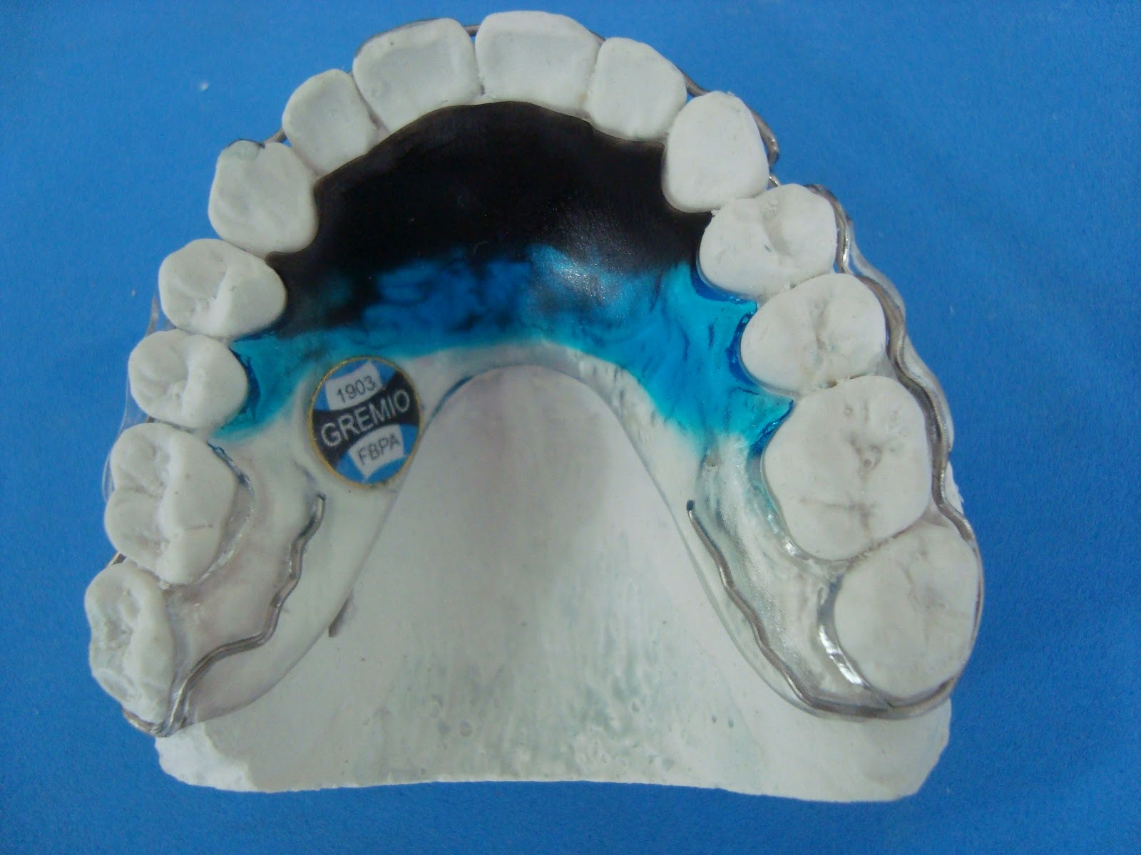 Laboratório Ortodôntico Bohrer: CONTENÇÃO ARCO CONTINUO