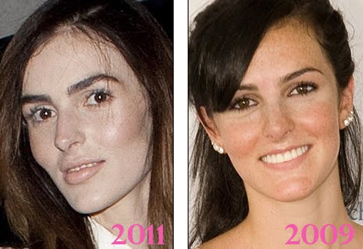 SHAMPALOVE: What the Hell has Happened to Ali Lohan