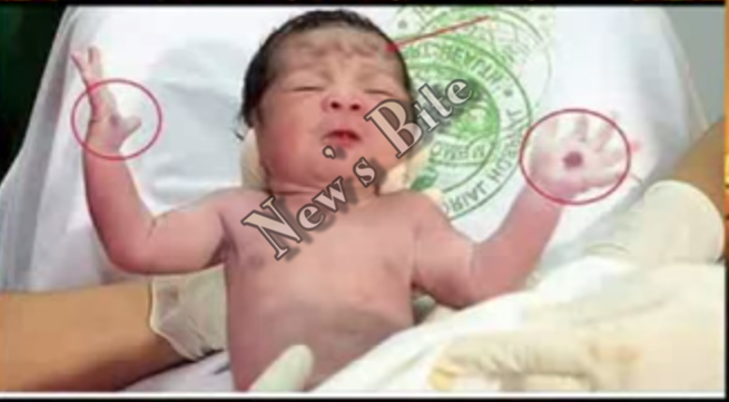 Viral: Newly Born Baby Shows Signs Of Stigmata That Christ Suffered ...