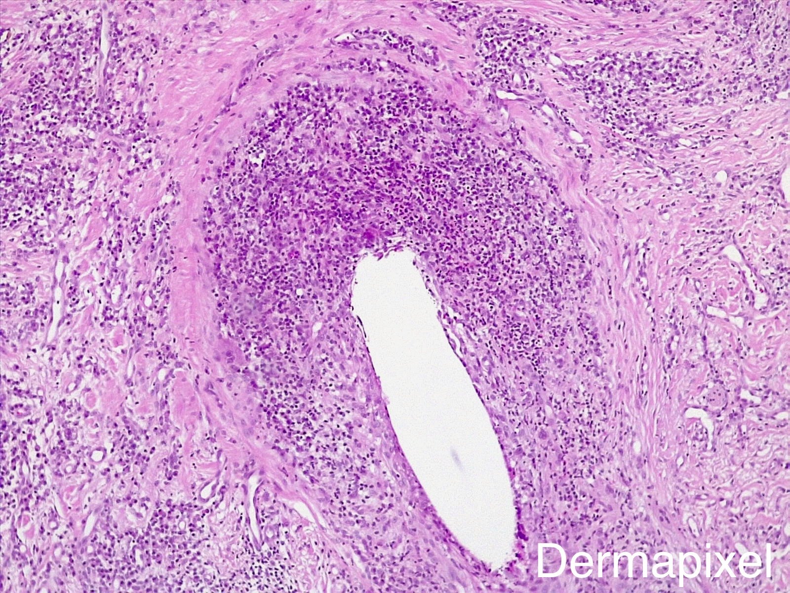 Dermapixel: abril 2018