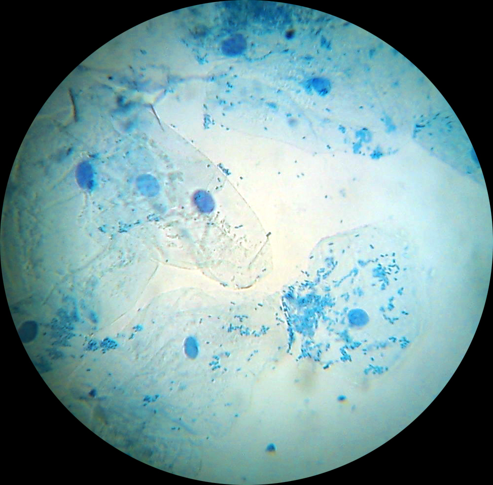 - Cousas de Bioloxía -: Frotis do epitelio bucal tinguido con azul de ...