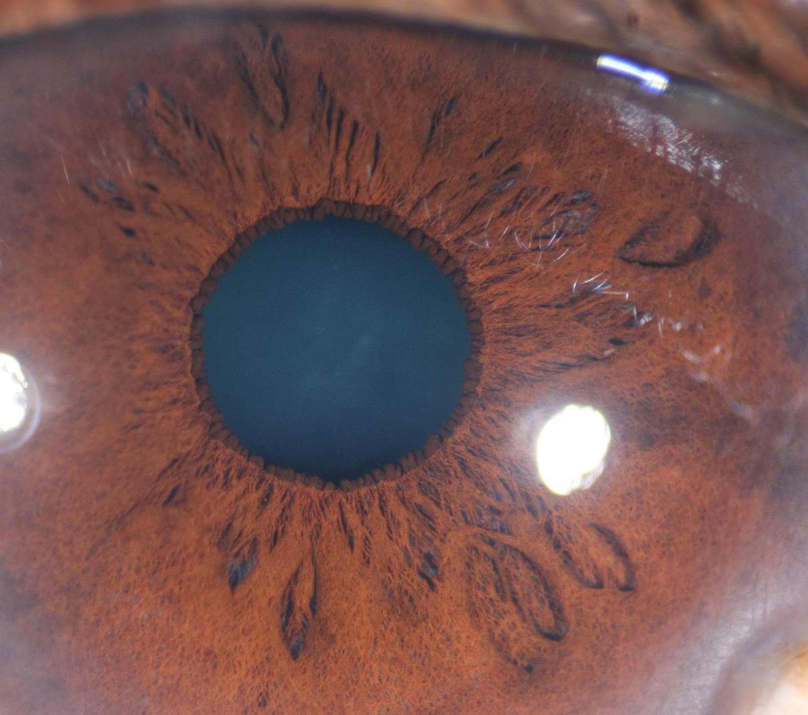 Modern & Multidimensional Iridology: IPB Morphologies, Pupil ...