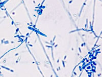Microbiología y Epidemiología: Trichophyton rubrum. Trichophyton ...