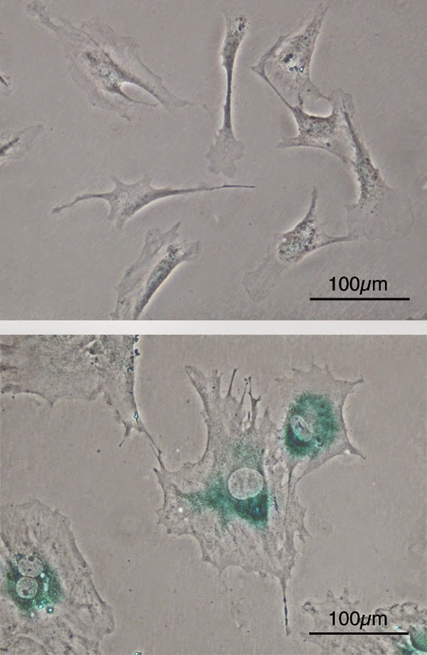Trailing Normal: Senescent Cells & Aging