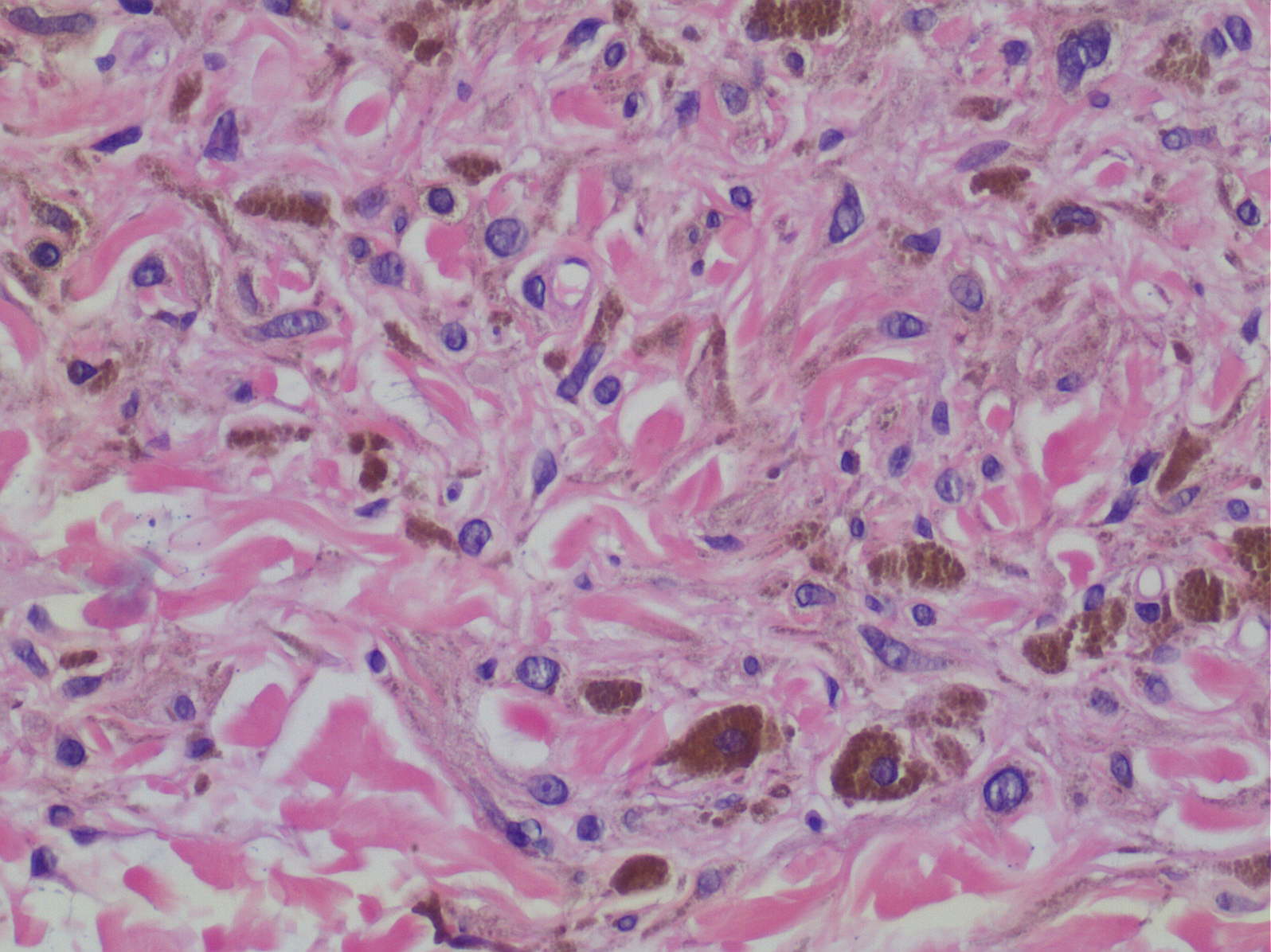 Nevo Azul é Perigoso - RETOEDU