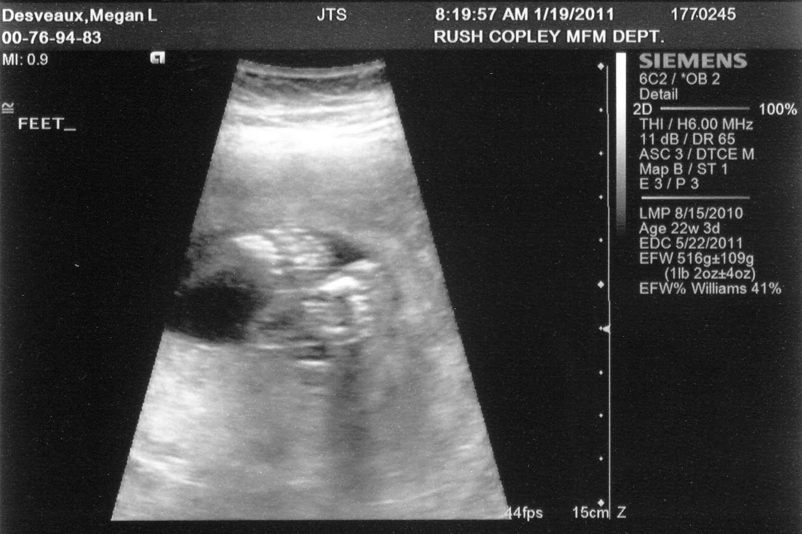 Devo Baby Blog: Ultrasound #3