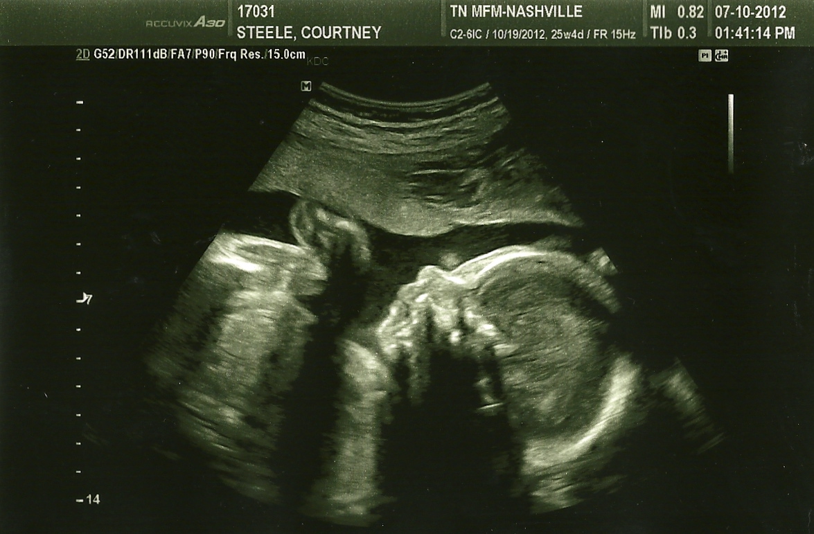 The Steeles: Baby Weeks 25-27