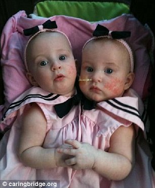 AMAZING STORIES AROUND THE WORLD: Shocking x-ray shows the complicated ...