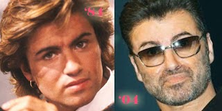 George Michael Plastic Surgery Botox, Nose Job Before and After Photos ...