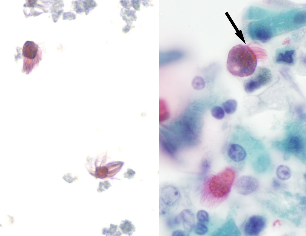 Creepy Dreadful Wonderful Parasites: Answer to Case 419