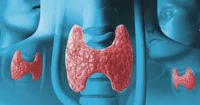 HIPOTIREOIDISMO SUBCLINICO - SAIBA CORRETAMENTE;Dr. João Santos Caio Jr ...