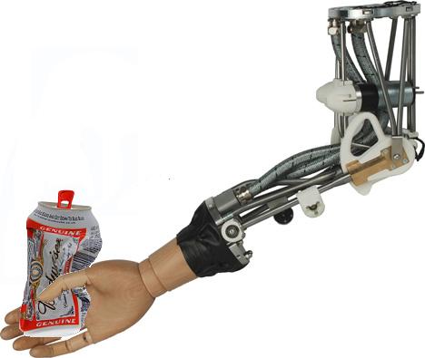 Gbigs Angle: Advanced Bionic Arm Crushes A Beer Can