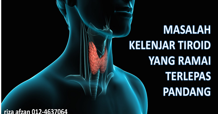 MY Health Venture: Masalah Kelenjar Tiroid Yang Ramai Terlepas Pandang