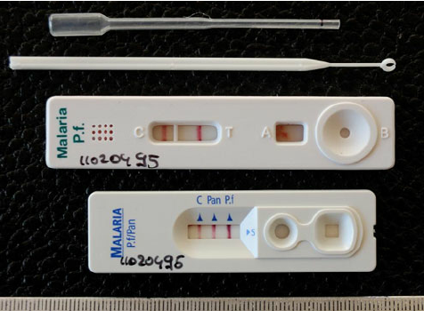 DIAGNOSIS OF BALANTIDIUM COLI AND PRASMODIUM SPECIES