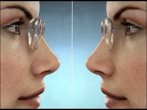 What are High Index Lenses? - Eye Health Nepal, Eye Problems, Eye ...