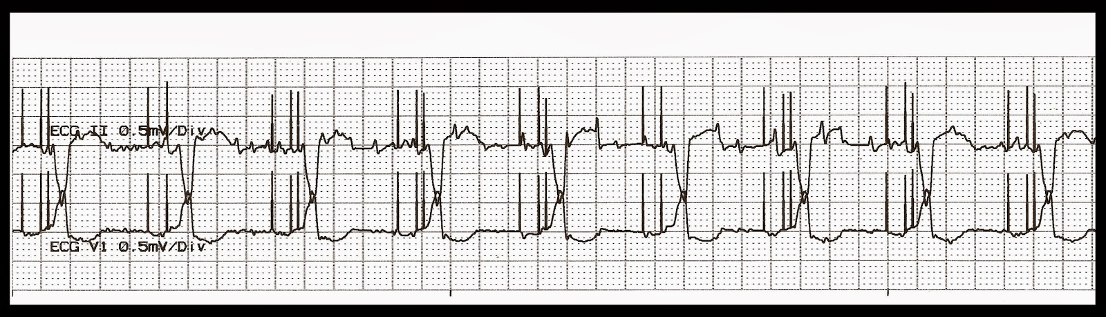 EKG Rhythm Quiz 290