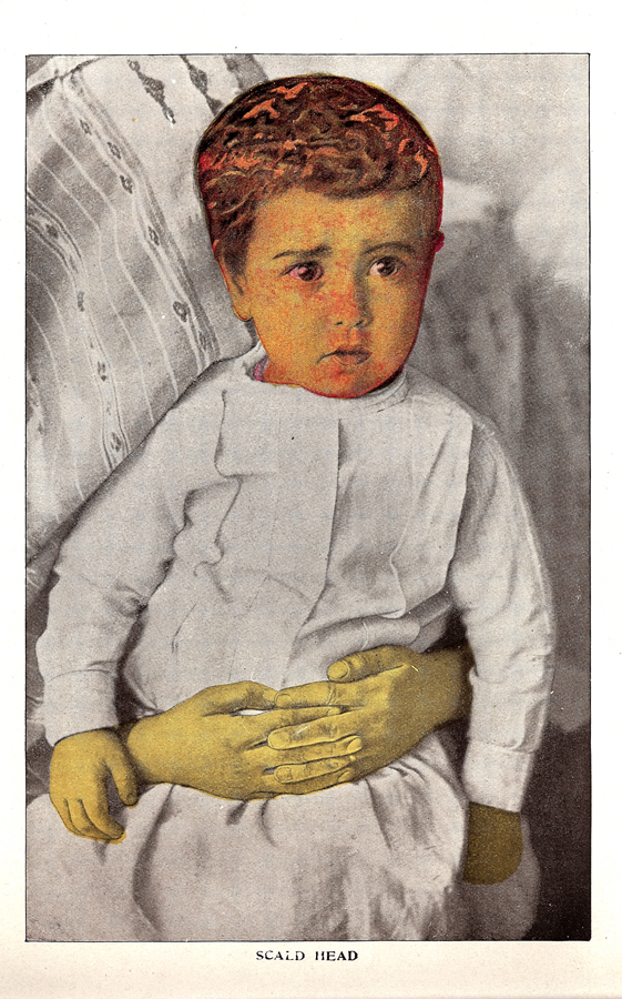 A POSTCARD ALMANAC: Boxer & Scald Head