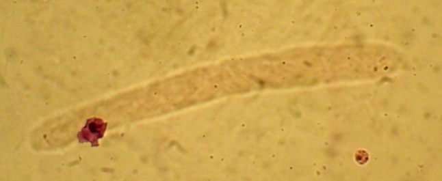 Sedimento urinario: febrero 2016