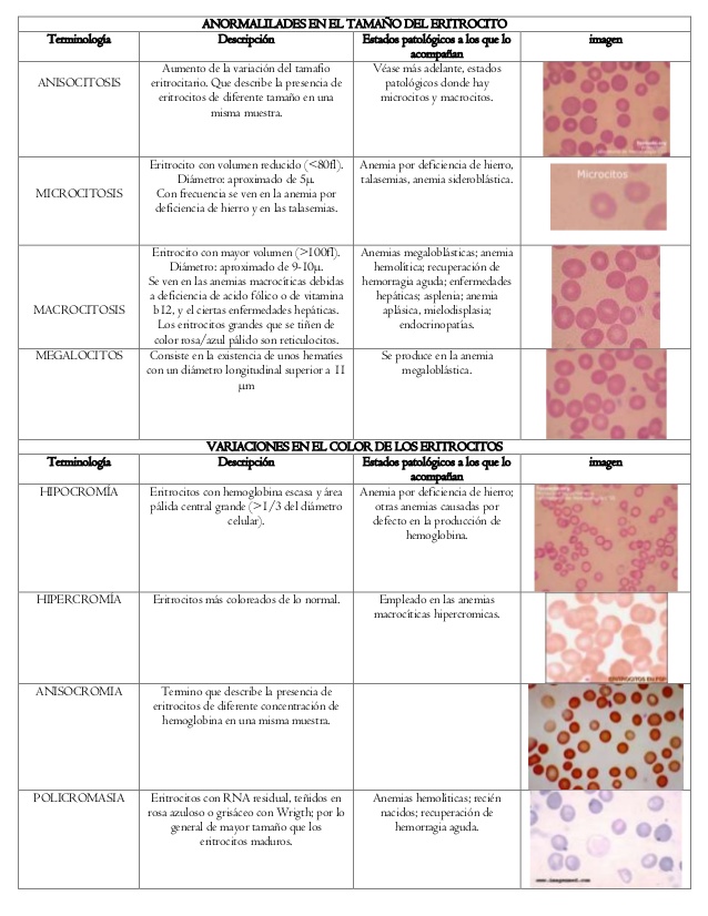 Laboratorista Clínico Majos: Anormalidades de los eritrocitos