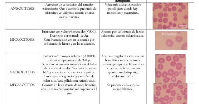 Laboratorista Clínico Majos: Anormalidades de los eritrocitos