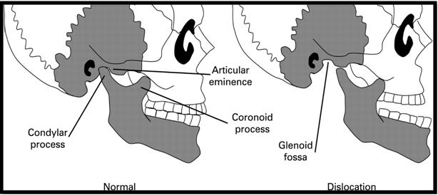 Royal Glamour Radiologi: Temporo Mandibular Joint (TMJ)