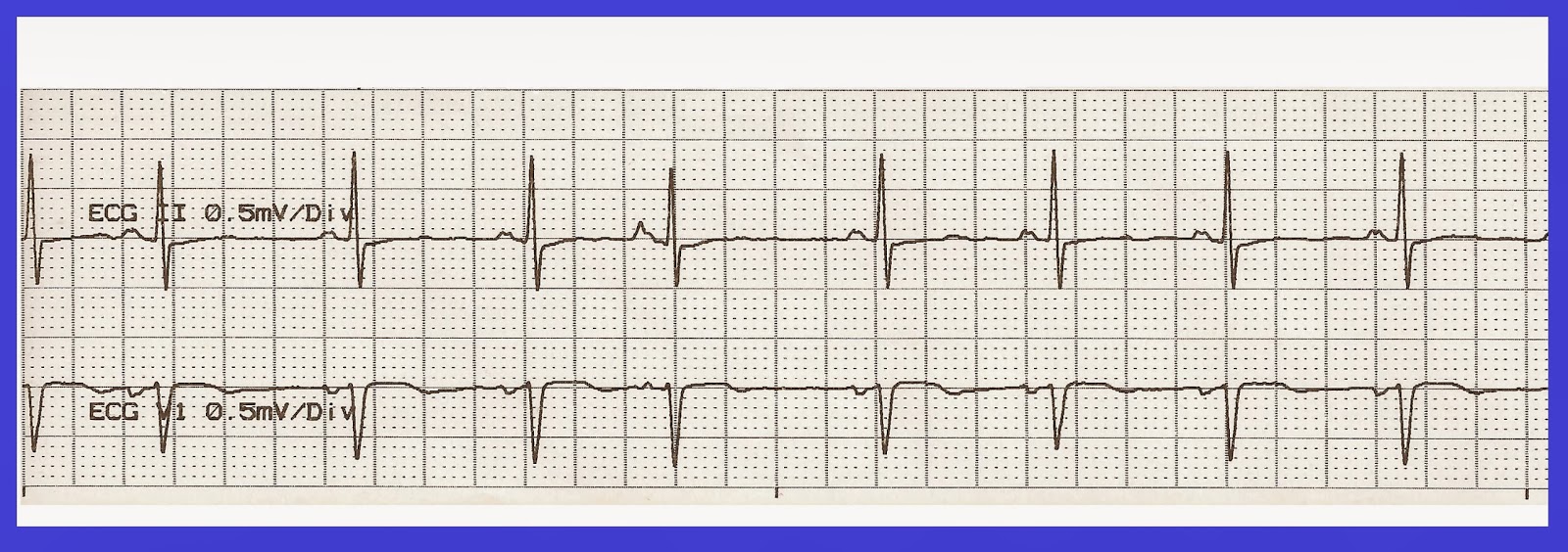 Practice EKG Rhythm Strips 210