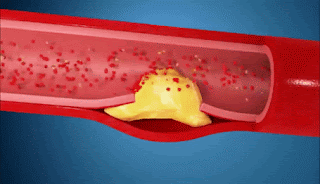 Ciências - 7º Ano: 10 doenças que mais matam no Brasil