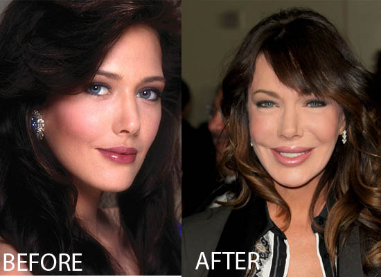 Hunter Tylo Surgery