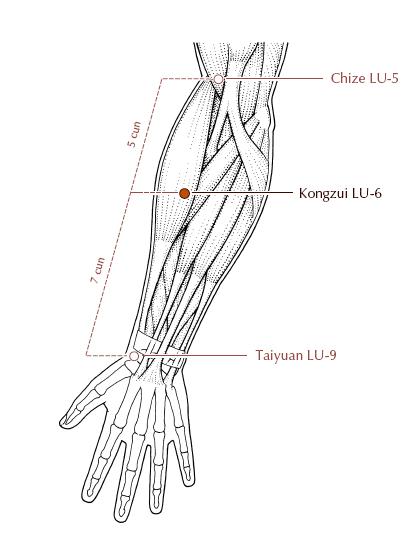 Acupuncture: Xi Cleft Points Acupuncture