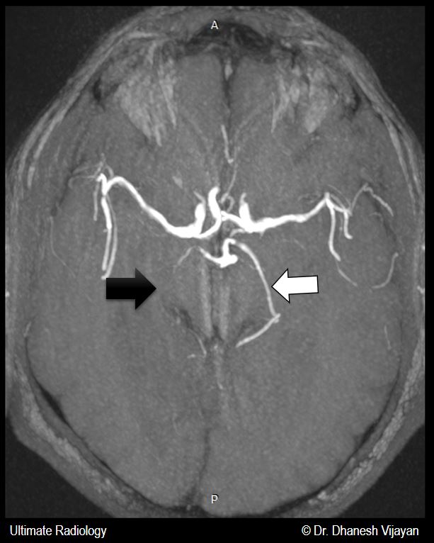 Ultimate Radiology : July 2017