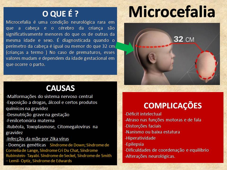 Microcefalia: o que é; causas e complicações