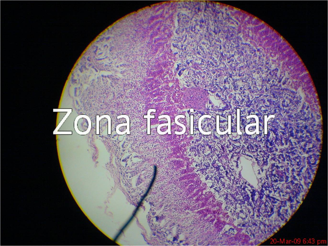 Zona fascicular; Capa Fasciculada Adrenal; Capa Fasciculada Suprarrenal ...