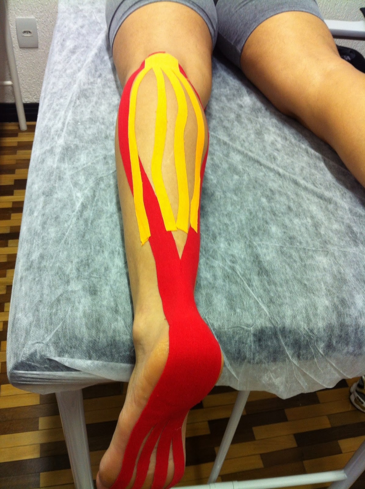 Drenagem Linfática Manual sem Creme: Lymph Taping: uma nova abordagem ...