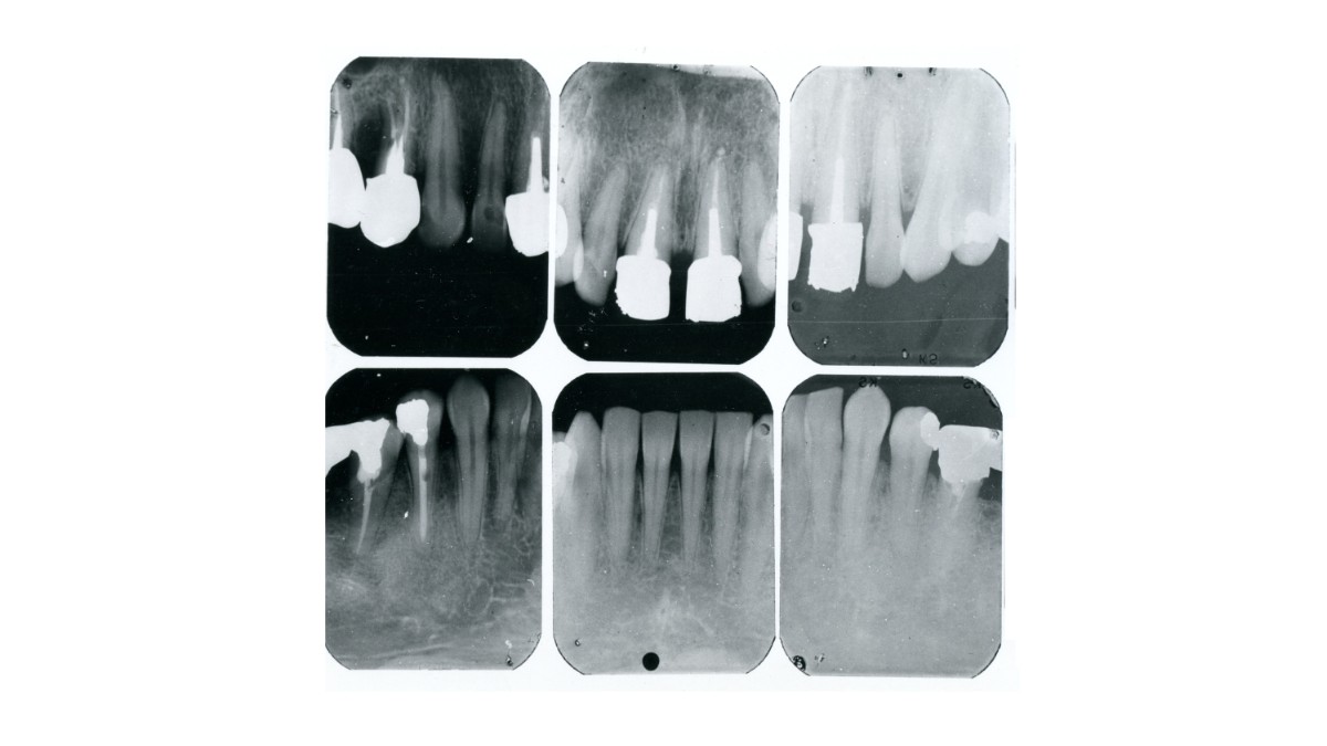 a personal FODMAP survival story (and the meaning of life): Isdal woman ...