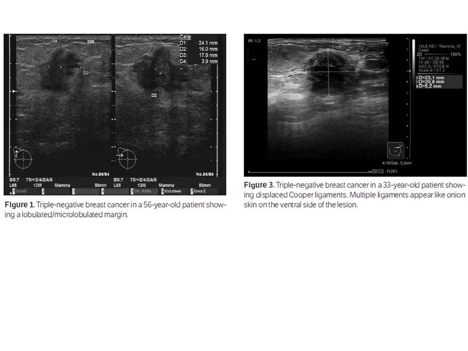 BÀI SOẠN VỀ SIÊU ÂM CHẨN ĐOÁN: Different Sonographic Features of Triple ...
