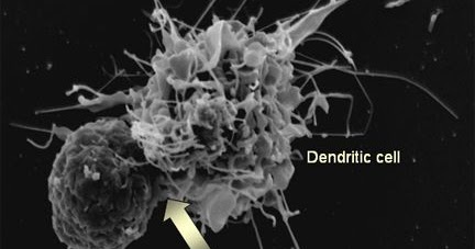 Celula dendritica