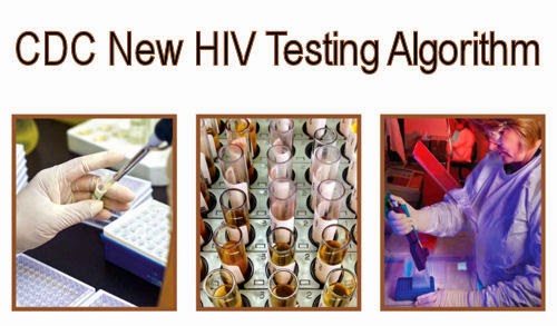 Medical Laboratory and Biomedical Science: CDC New HIV Testing Algorithm