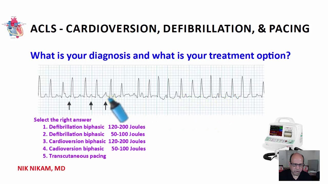Cardioversion