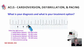 Cardioversion