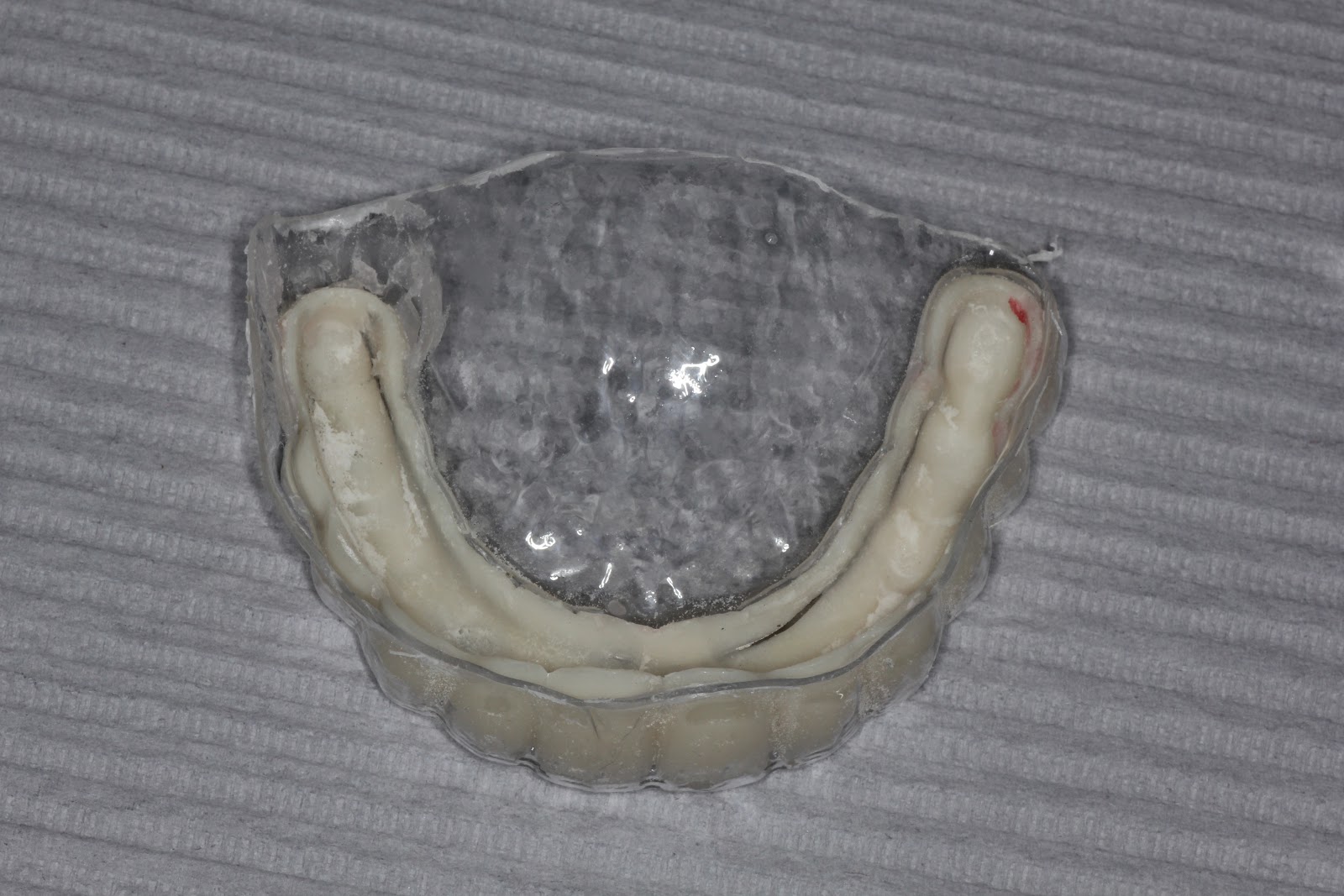 The DMD and MDT Learning Blog: New Materials, New Methods, Patient Wins ...