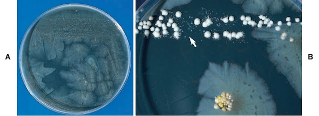 [Microbiology] Atlas of Haemophilus and Other Fastidious Gram-Negative ...