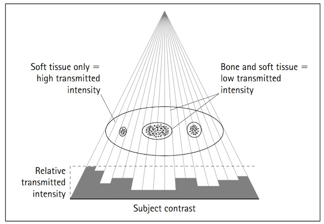 Clark's Radiography: Density and contrast