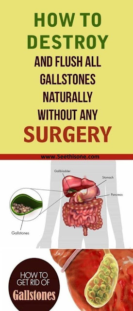 HOW TO DESTROY AND FLUSH ALL GALLSTONES NATURALLY WITHOUT ANY SURGERY ...