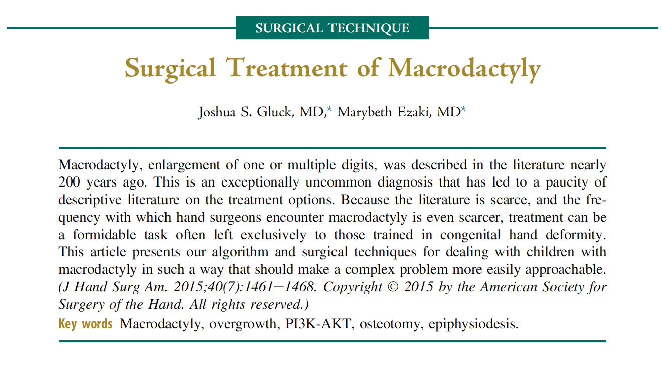 Macrodactyly, Syndactyly, and Keloid | Congenital Hand and Arm ...