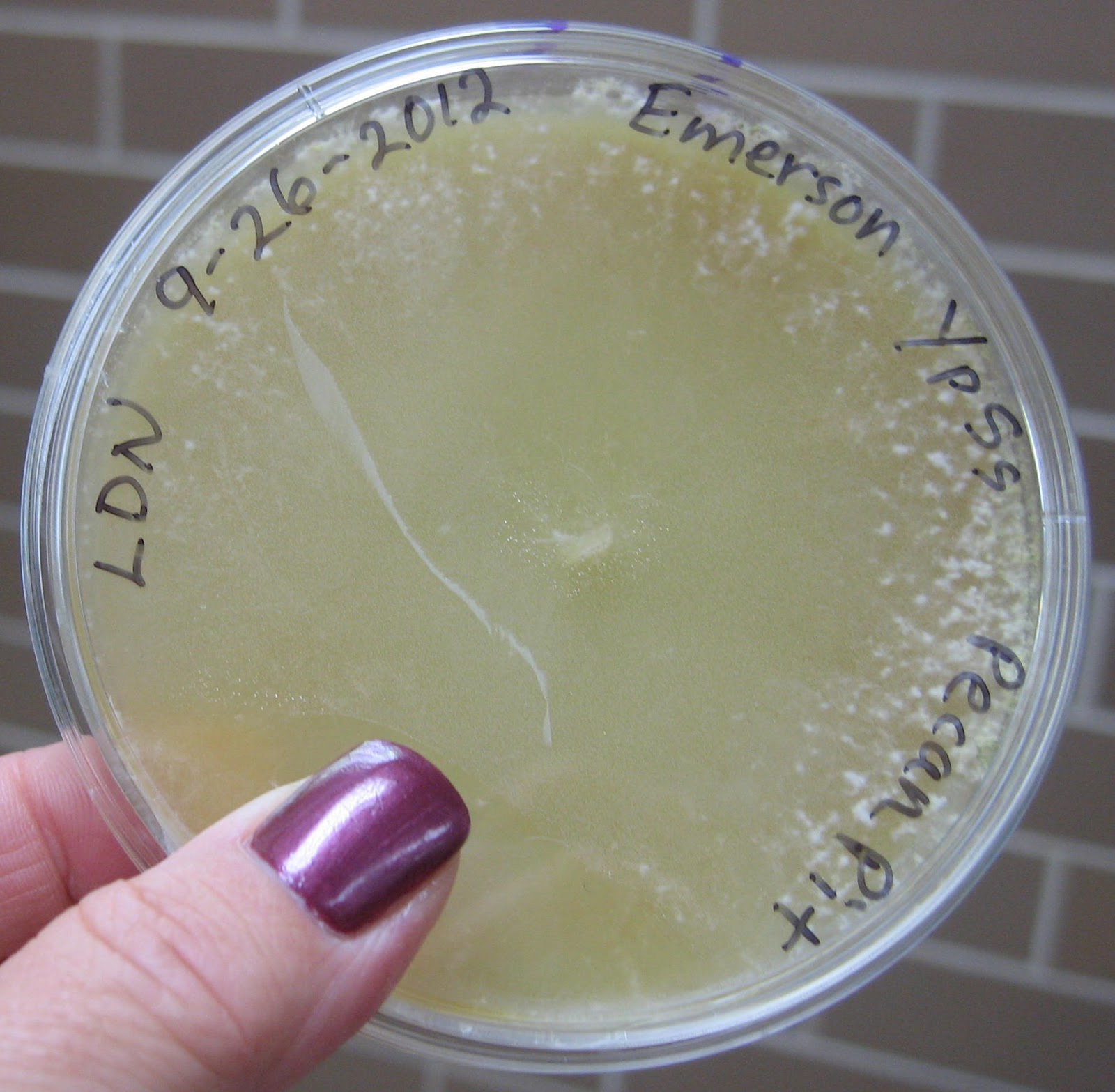 TAMU_PLPA631_FungalBlog_LornaNissen: Lab 4