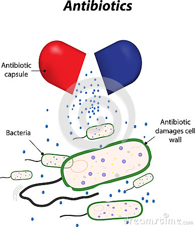 Antibiotics as a Cure for Stomach Ulcer | Take One Action