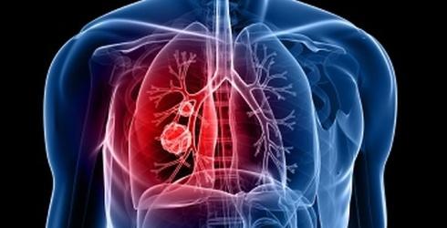 Cough Info: Dry cough causes and the treatments