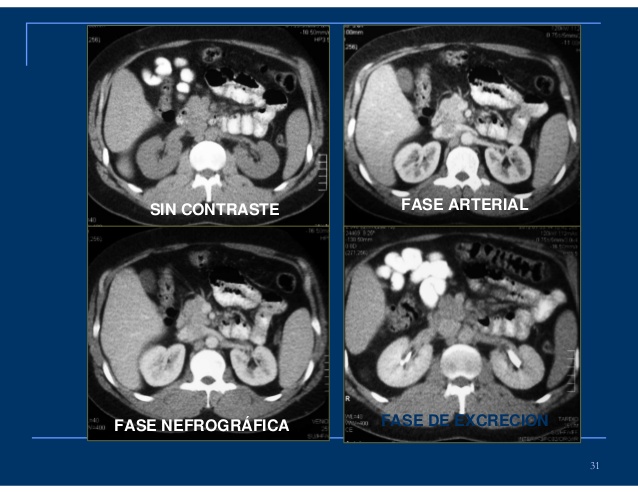 Imagenologia en la Web: FASES DURANTE LA TOMOGRAFIA CON CONTRASTE ...