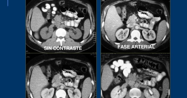 Imagenologia en la Web: FASES DURANTE LA TOMOGRAFIA CON CONTRASTE ...