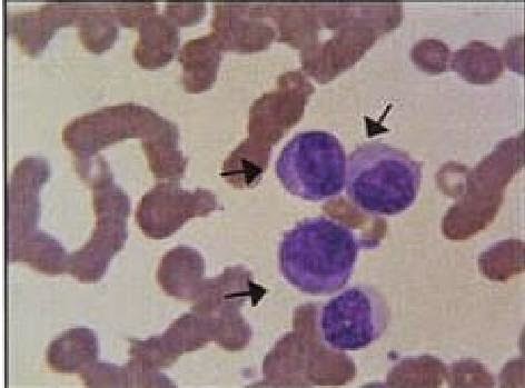 fichero hematologia: Mielocito